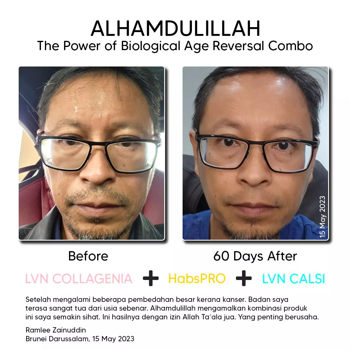 Ini Kombinasi 3 Produk PT BEST untuk Membantu Penyembuhan Penyakit!